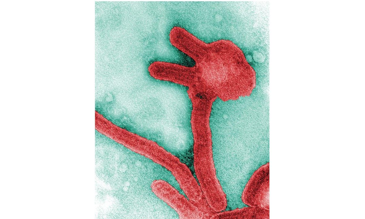 What is the Outbreak in Uganda: What Is the Marburg Virus? Virus ...
