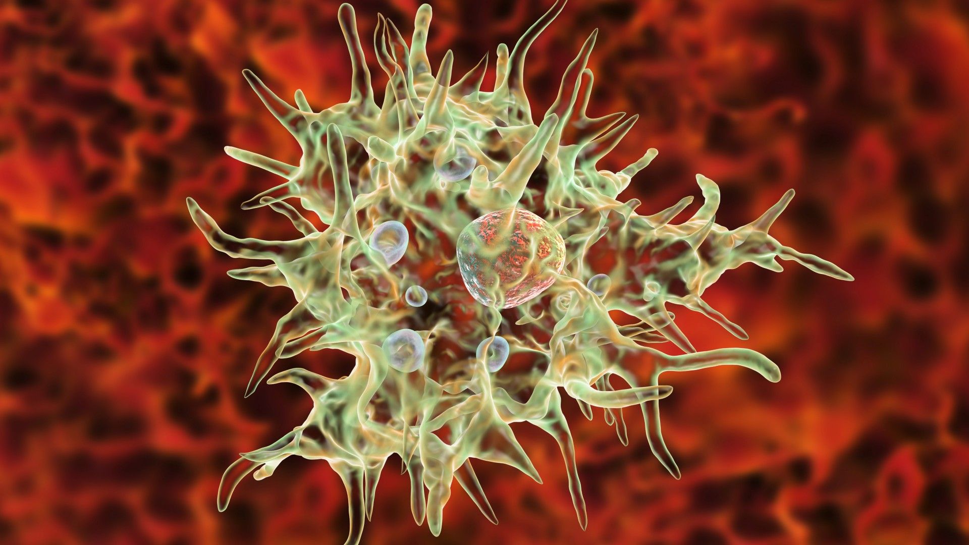 Deadly amoeba brain infection can result from unsafe nasal rinsing, CDC ...