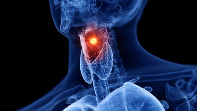 The 10 deadliest cancers, and why there's no cure | Live Science