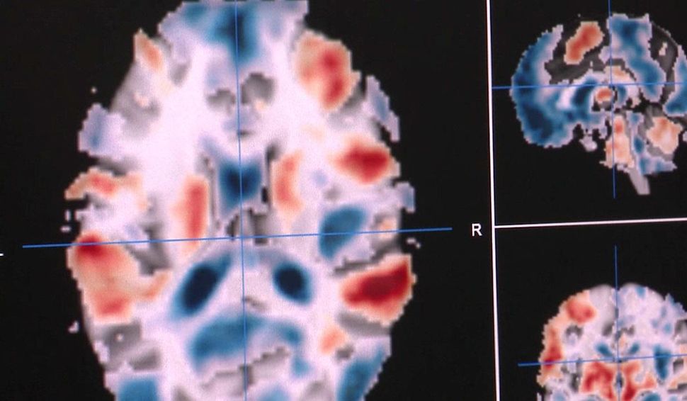 People Can Consciously Control Mental Activity Using Brain Scans | Live ...