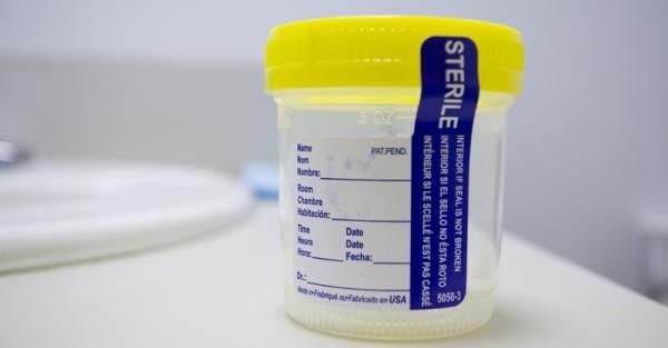 The Fascinating History of Urine Tests | Live Science The Fascinating History of Urine Tests | Live Science
