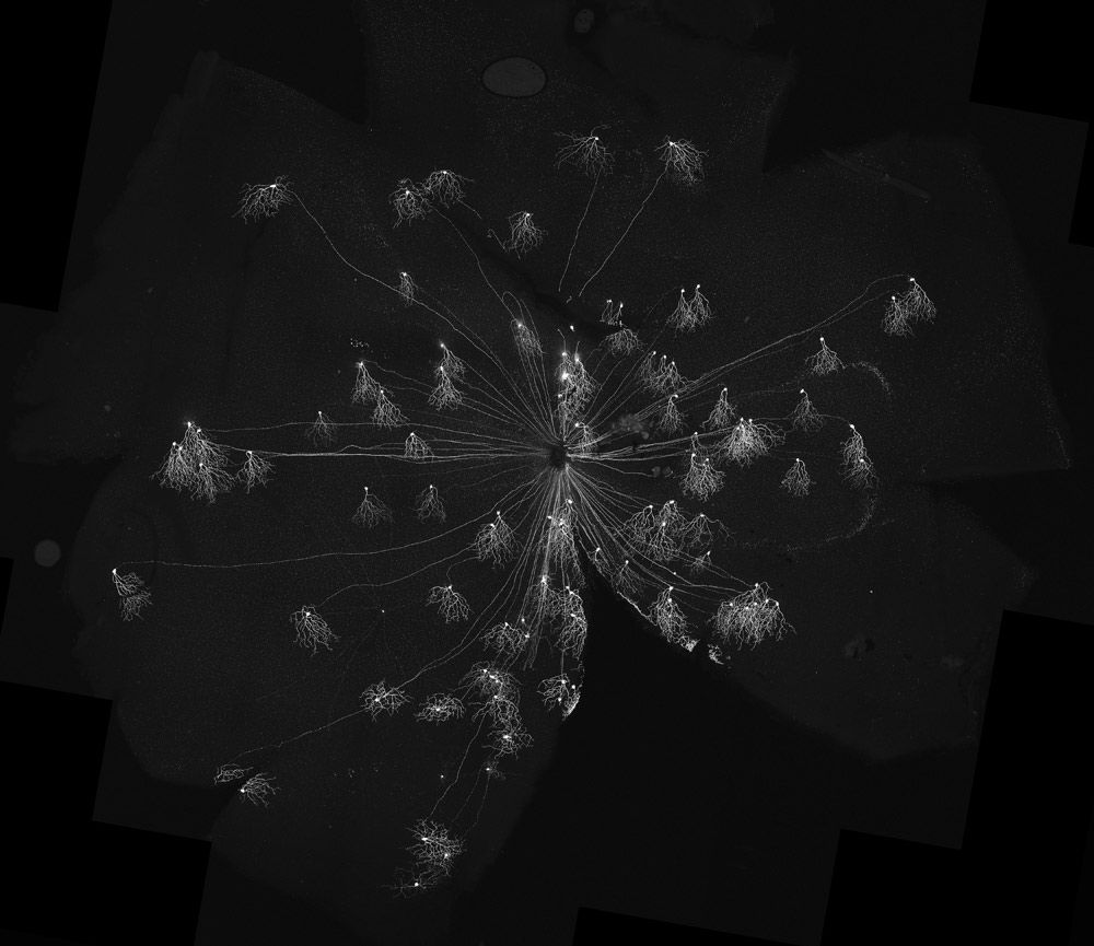 Inside the Brain: A Photo Journey Through Time | Live Science