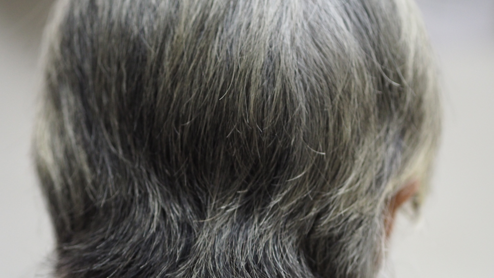 Gray hair may have evolved as a protection against cancer, study hints ...