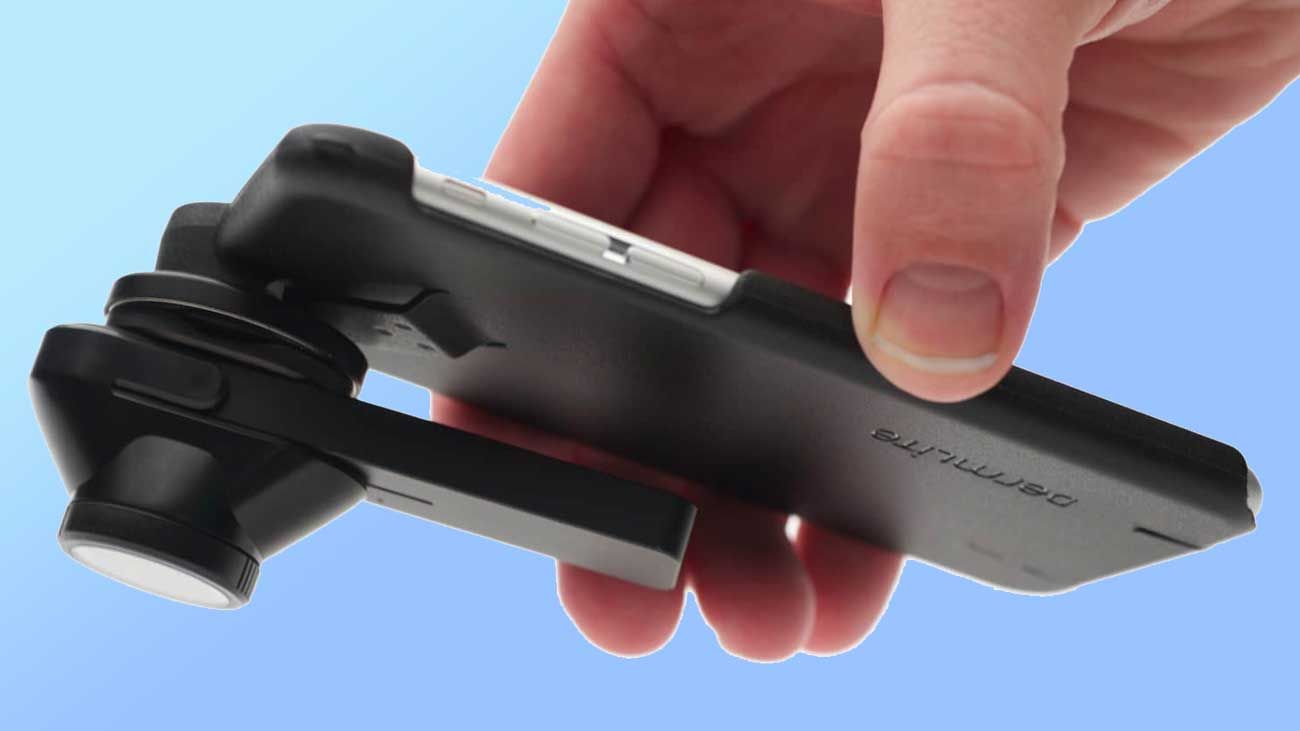 UK doctors now using smartphones and AI to help diagnose skin cancer ...