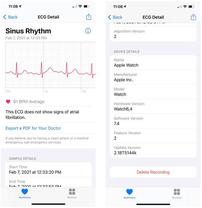 ECG Apple Watch App: The Ultimate Guide | iMore