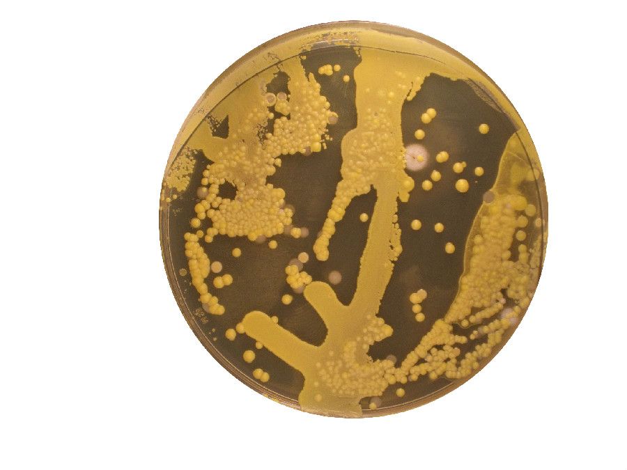 Gallery: Bacteria in Your Belly Button | Live Science