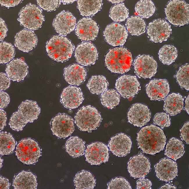 How Smallpox Changed the World | Live Science