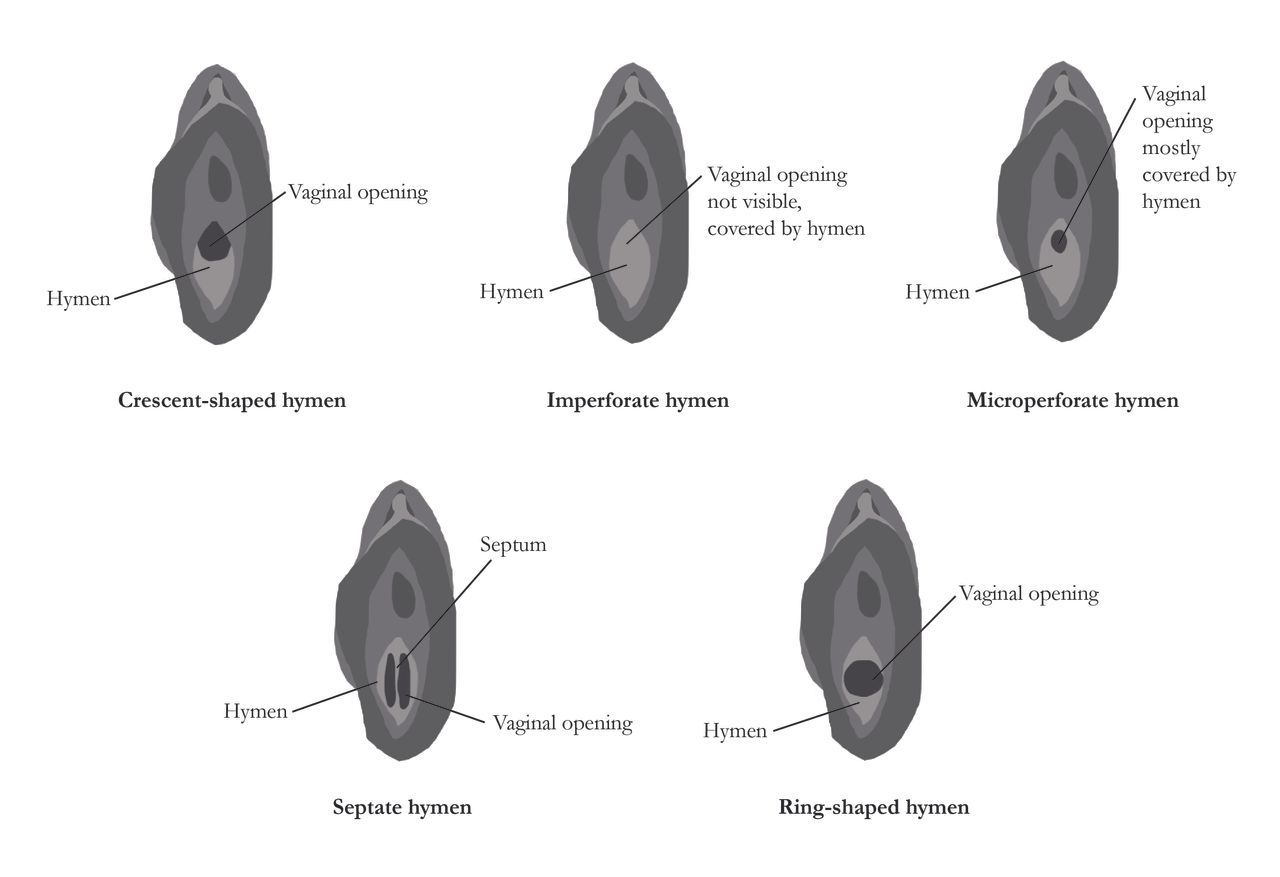 What does a normal vagina look like? A no nonsense guide to vaginas and ...