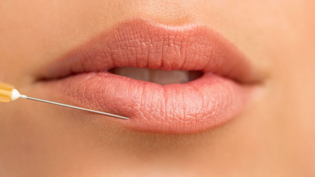 5 Causes of Cold Sores on Your Lips and How to Get Rid of Outbreaks ...