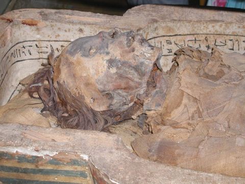 Image Gallery: Mummy Evisceration Techniques | Live Science