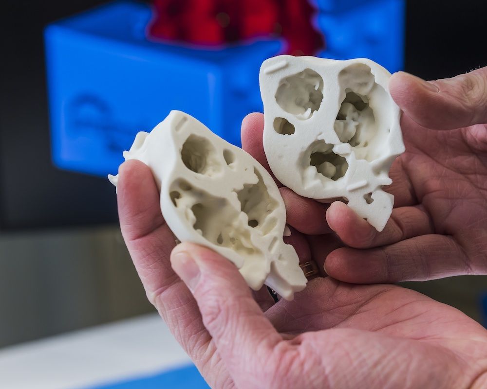 Surgeon's Helper: 3D Printing Is Revolutionizing Health Care | Live Science