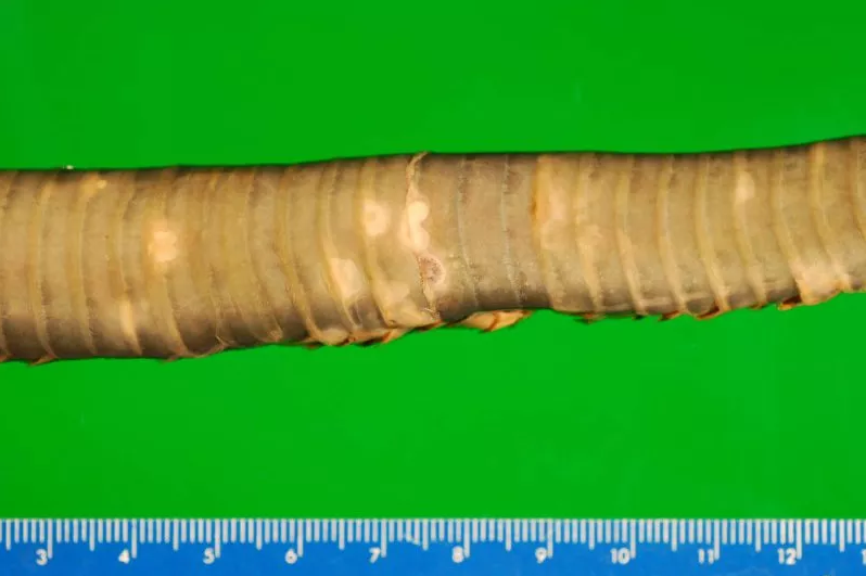 Photos: How a Fungal Disease is Disfiguring Snakes | Live Science