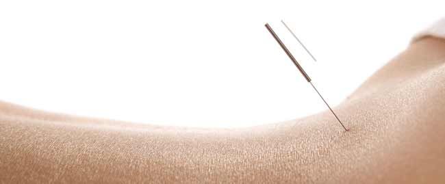 5 Painful Facts You Need to Know | Live Science