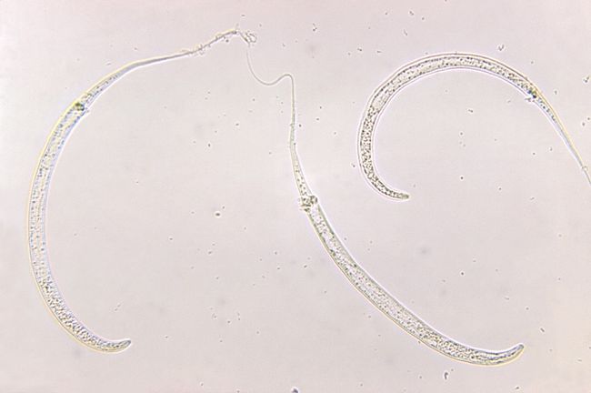 Images: Human Parasites Under the Microscope | Live Science