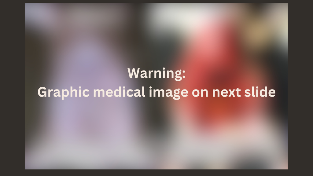 Scientists just made mice 'see-through' using food dye — and humans are ...