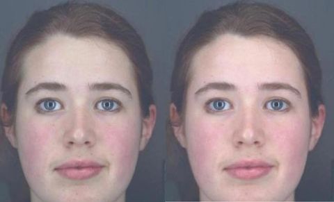 Rosy Complexion Is Sign of Health | Live Science
