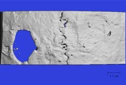 Bionic Humans: Top 10 Technologies | Live Science