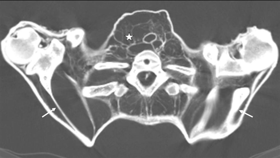 Image Gallery: The Mummy of King Ramesses III | Live Science