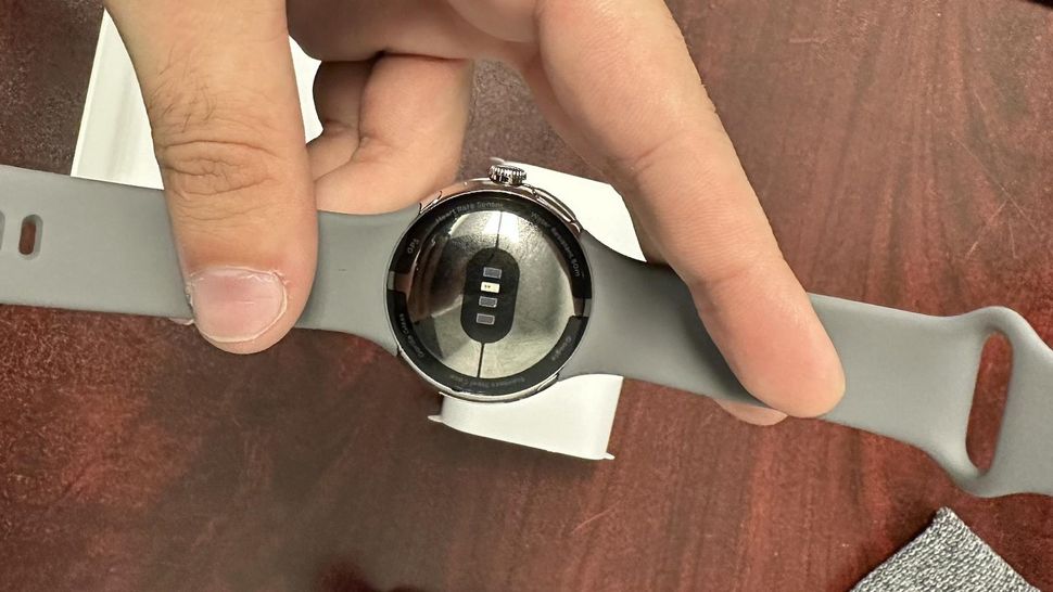 Pixel Watch looks slim and sleek in recent unboxing leak | TechRadar