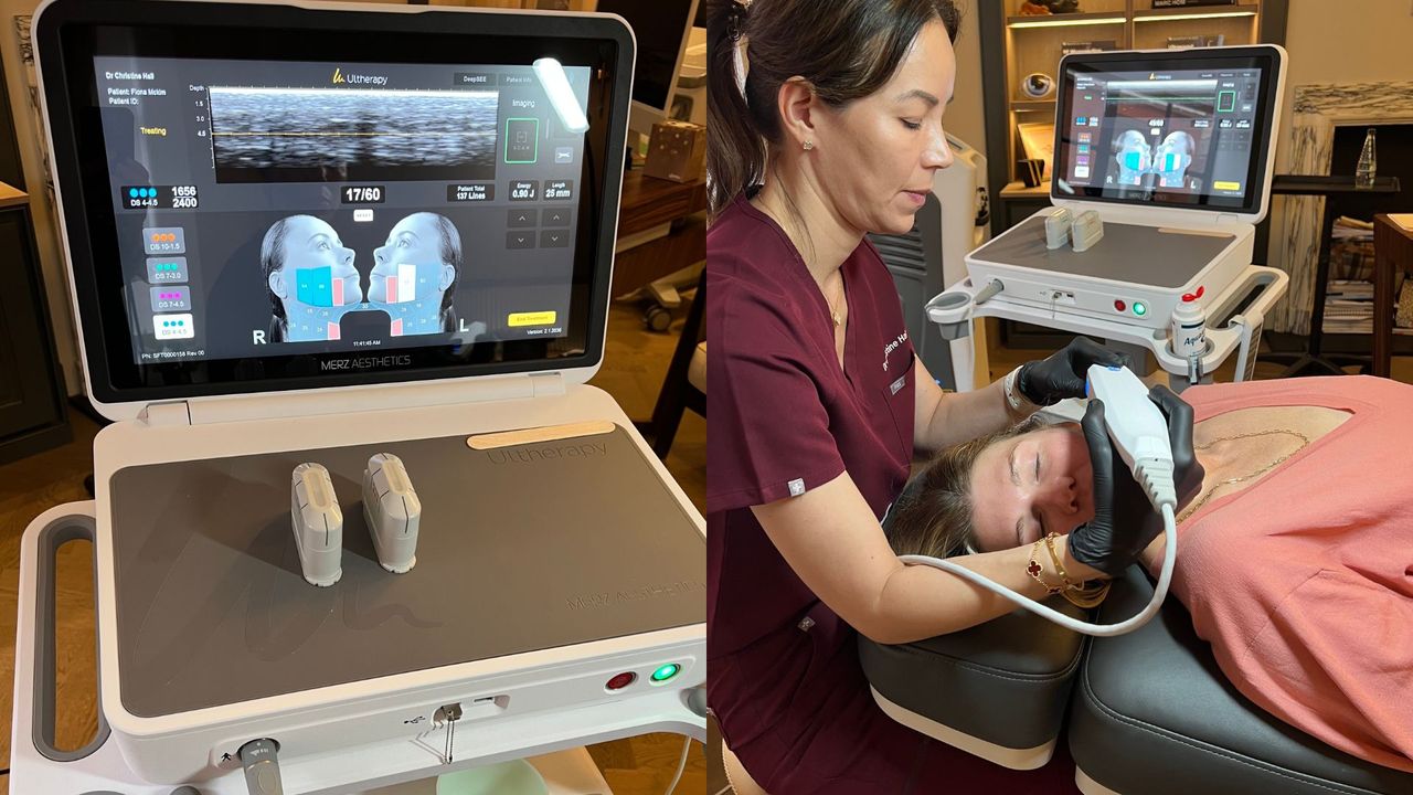 I tried Ultherapy Prime - the before & after pics say it all | Woman & Home