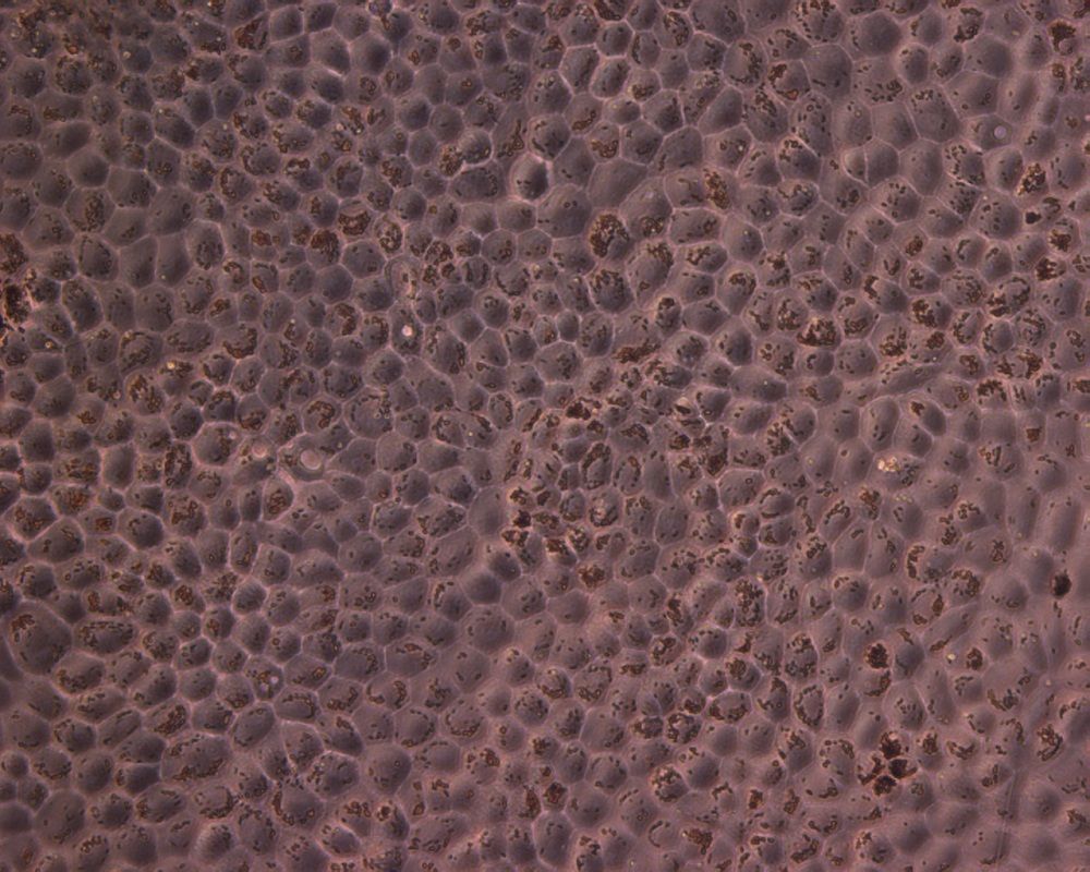 Eye Spy: Stem Cells Discovered in Eyeball | Live Science