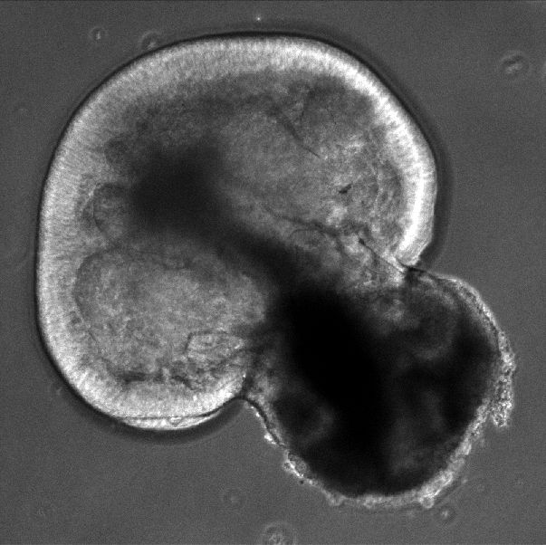 Lab-Grown 'Mini-Eyes' Show How Color Vision Develops | Live Science
