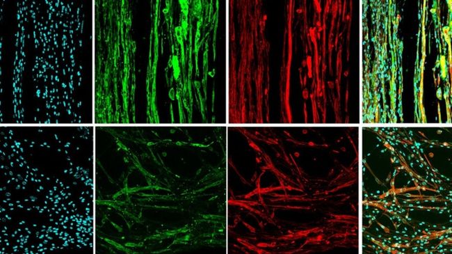 Scientists 3D printed muscle tissue in microgravity. The goal is to ...