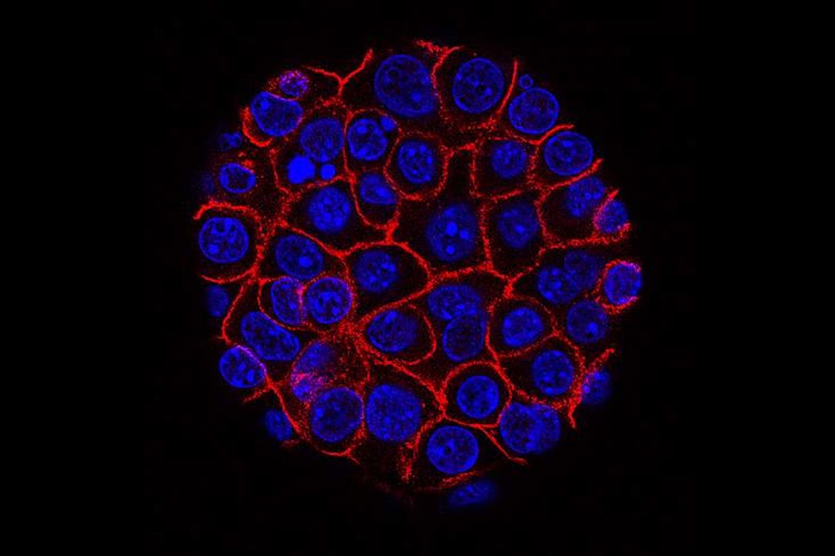 Cancer: Facts about the diseases that cause out-of-control cell growth ...
