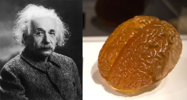 Where is Einstein's brain? | Live Science