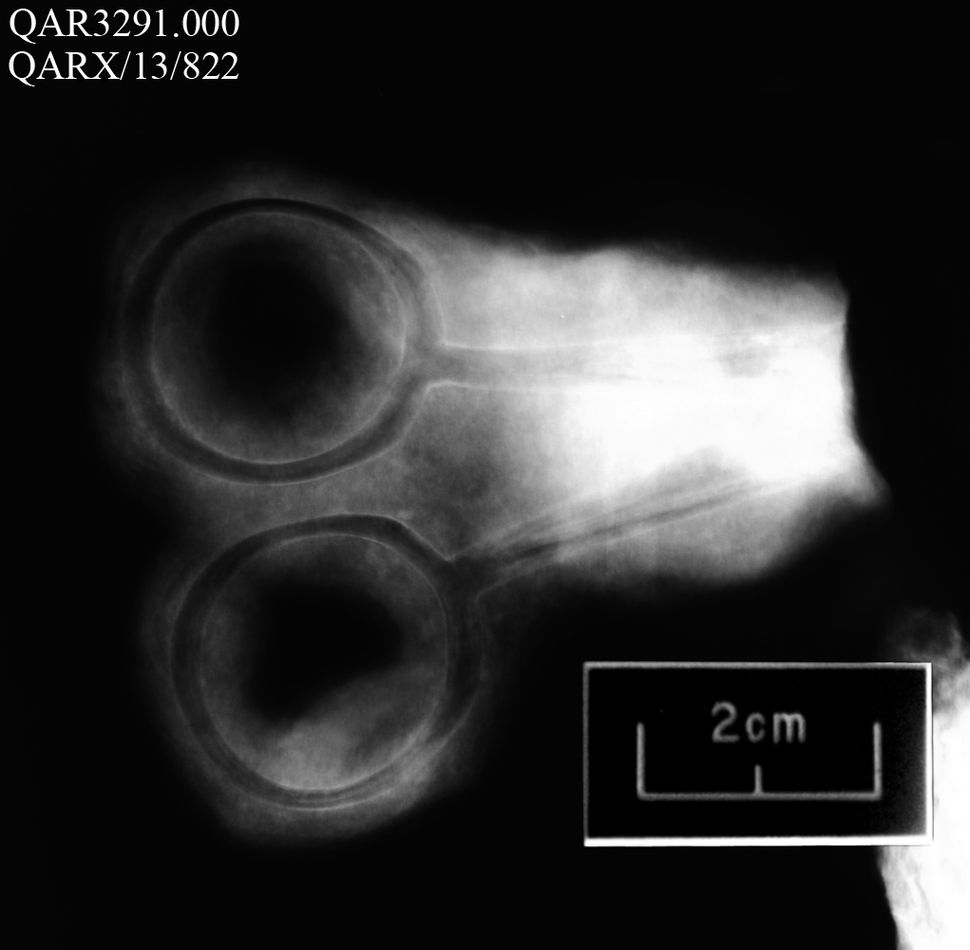 Photos: The Medical Instruments Found on Blackbeard's Ship | Live Science