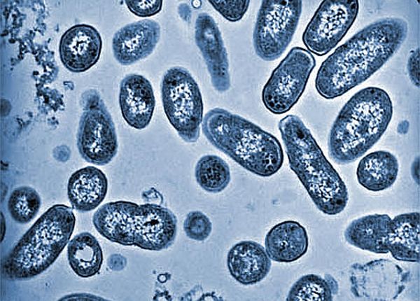 Salmonella's Secret: A Chemical That Isn't Only in Corpses | Live Science