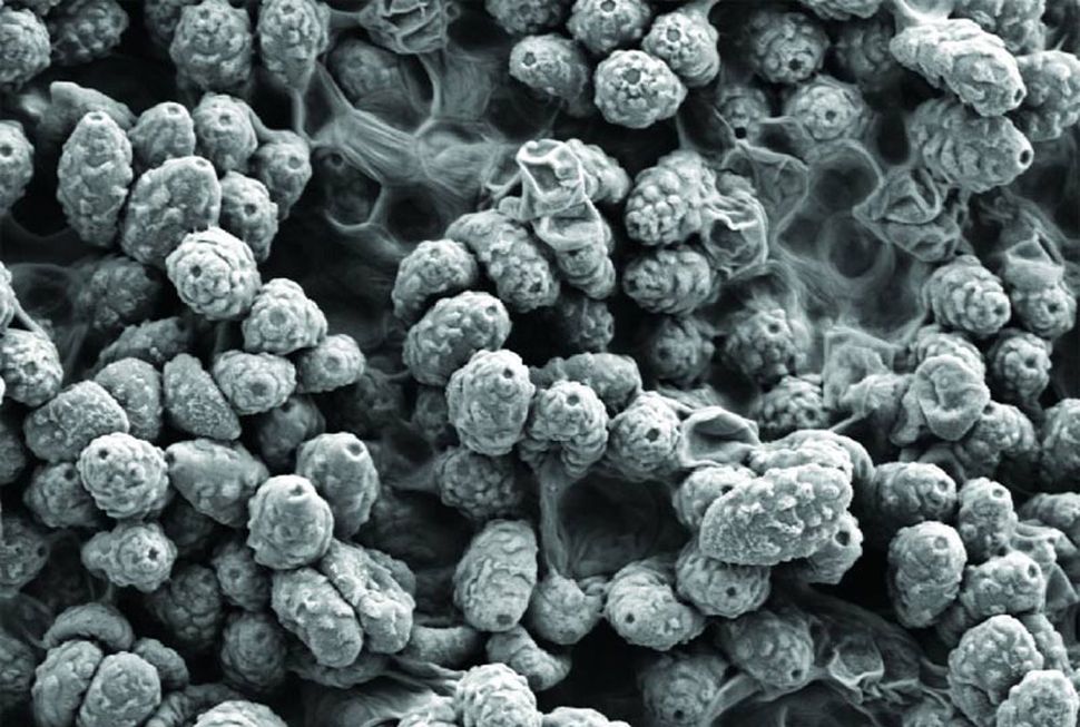 Microscopic Worlds Gallery: Fascinating Fungi | Live Science