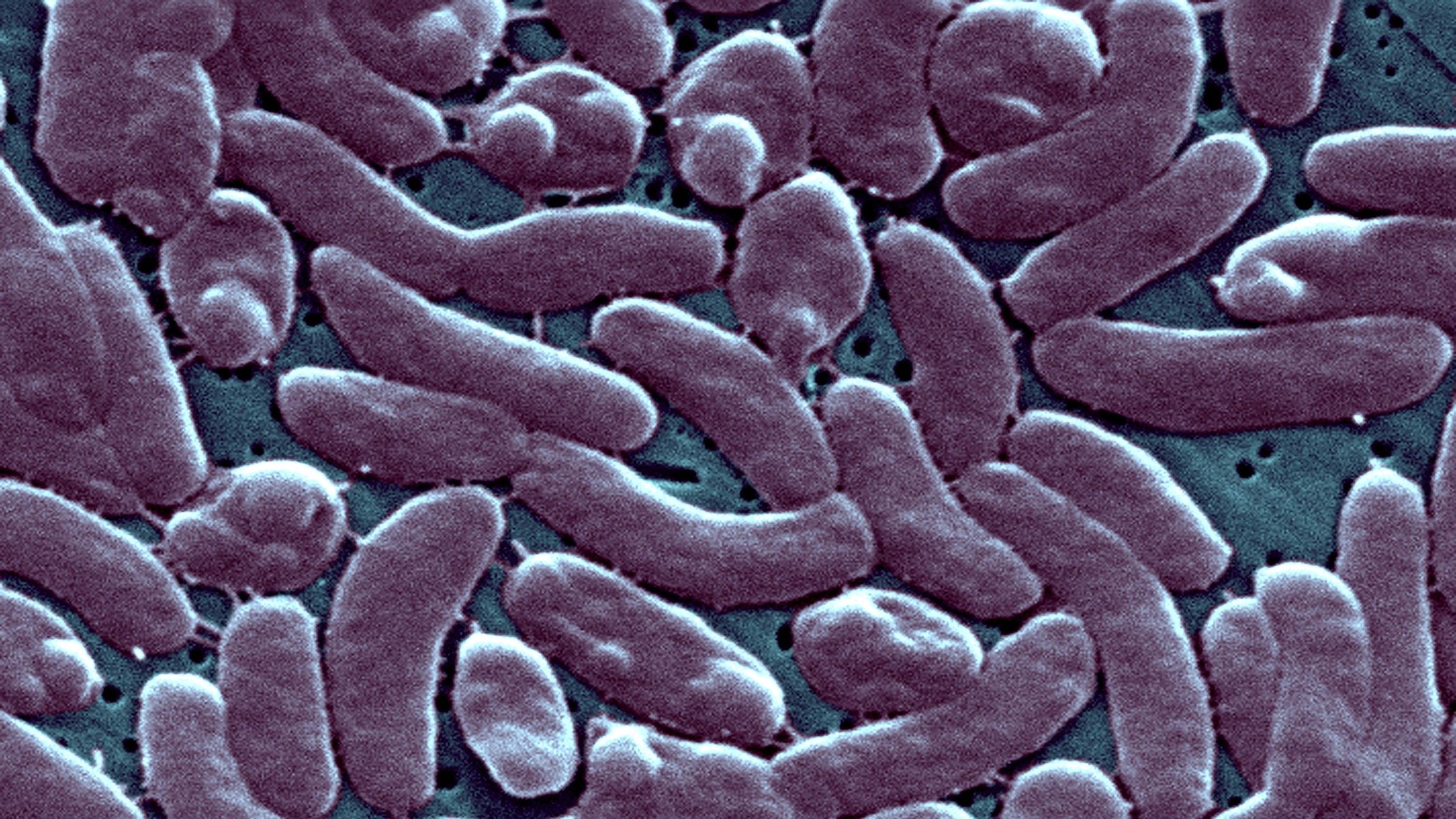 CDC health warning issued after 5 killed by 'flesh-eating' bacteria ...