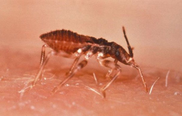 Chagas Disease vs AIDS | Live Science