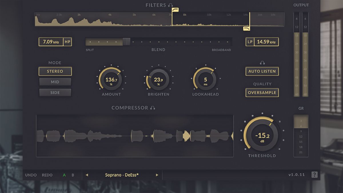 Solid State Logic DeEss review | MusicRadar