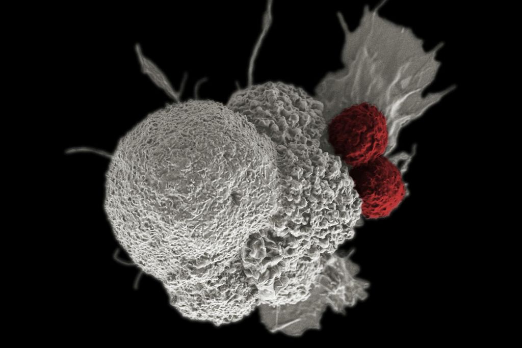 Cancer: Facts about the diseases that cause out-of-control cell growth ...