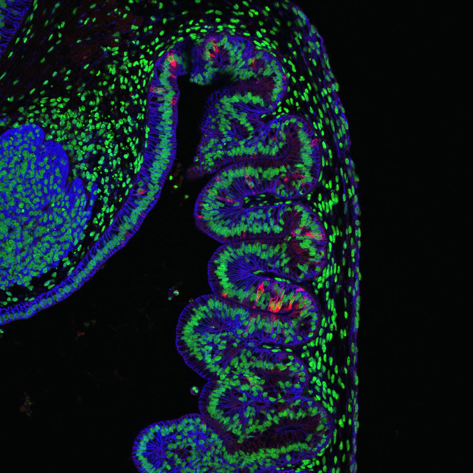 Image Gallery: Miniature Human Stomachs | Live Science