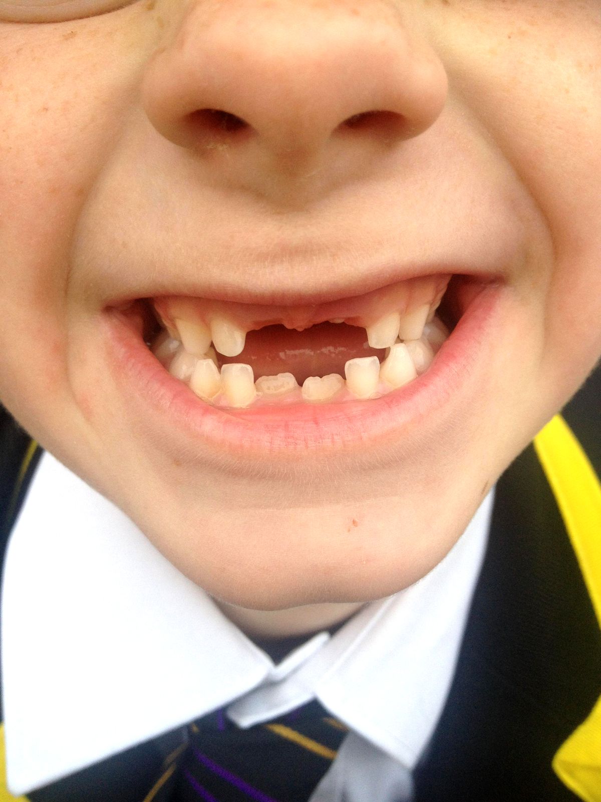 My kids have too many teeth | The Week