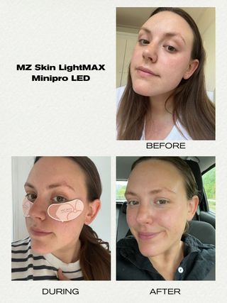 4 LED Eye Masks That Actually Work | Who What Wear