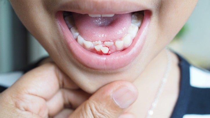 What causes bleeding gums? | Live Science