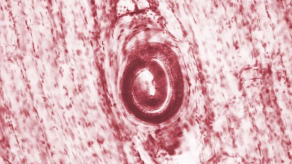 Parasitic worms infect 6 after bear meat served at family reunion | Live Science