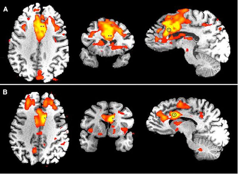 Human Perseverance Linked to Brain Region | Live Science