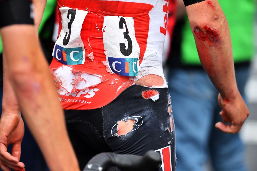 Road rash: how to treat skin abrasion after a cycling crash | Cycling ...