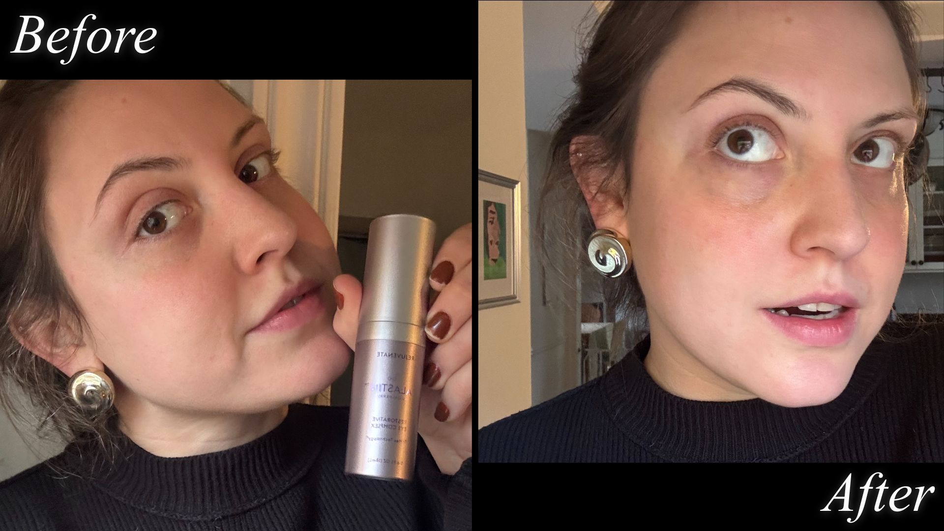 The 11 Best Hydrating Eye Creams, Tested by Editors | Marie Claire