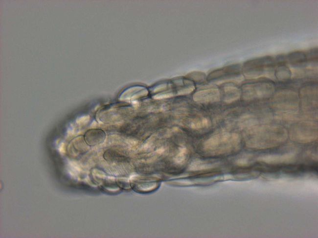 It's 3 a.m., Is that a Parasitic Worm in Your Cheek? (Op-Ed) | Live Science