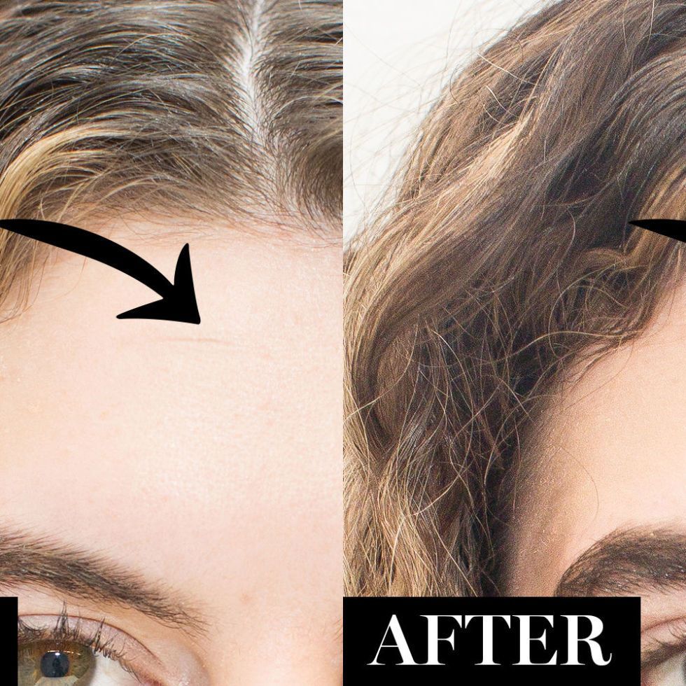 Botox Alternative Cream - How to Get Rid of a Wrinkle | Marie Claire