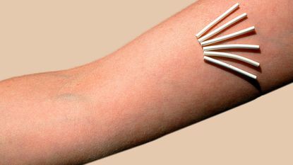 All the Birth Control Methods Out There: A Comprehensive List | Marie ...