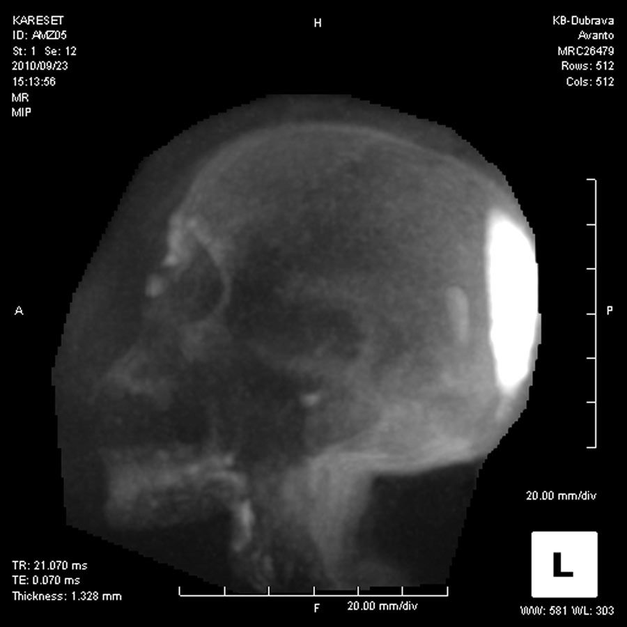 Ancient Egyptian Mummy Suffered Rare Disease | Mummy Science | Live Science