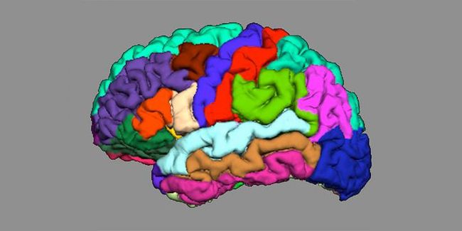 What the Folds of Your Brain Could Tell You About Schizophrenia Risk ...