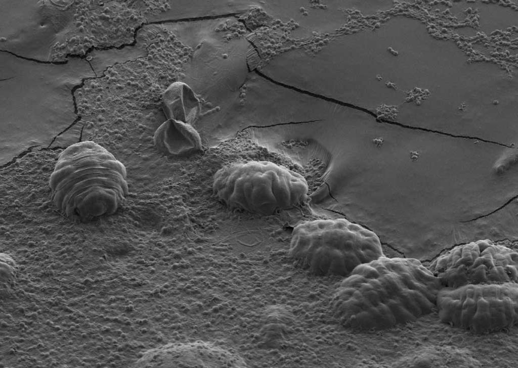 How Do Dried-Out Tardigrades Revive? It's in Their DNA | Live Science